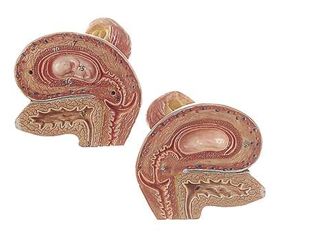 Internal Female Genital Organs (MS 42) · Anatomy models | SOMSO®