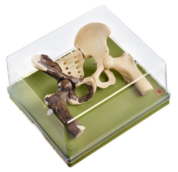 Reconstrucción de pelvis de Australopithecus africanus (S 5/STs14 ...