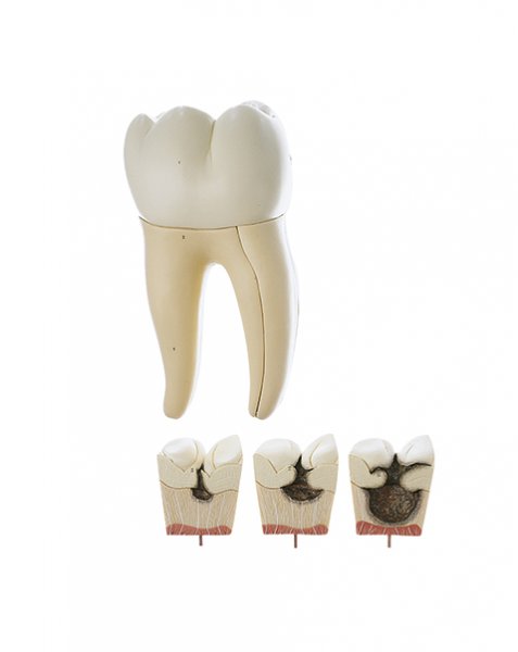 Primer molar inferior derecho (ES 12) · Modelos de anatomía | SOMSO®